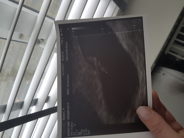 Echo 0210 | Brabbels FotoAlbum