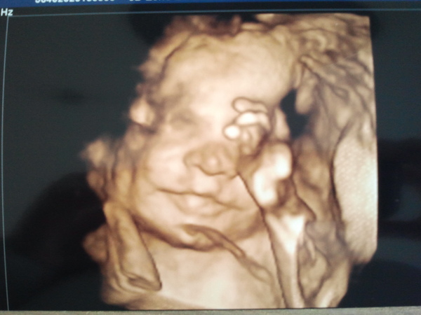 pretecho 28 weken | Brabbels FotoAlbum